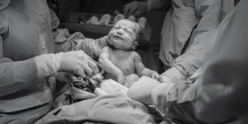 C-Section vs. Normal Delivery: Which One is Right for You? - Health ...