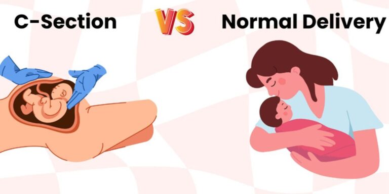 C-Section vs. Normal Delivery: Which One is Right for You? - Health ...
